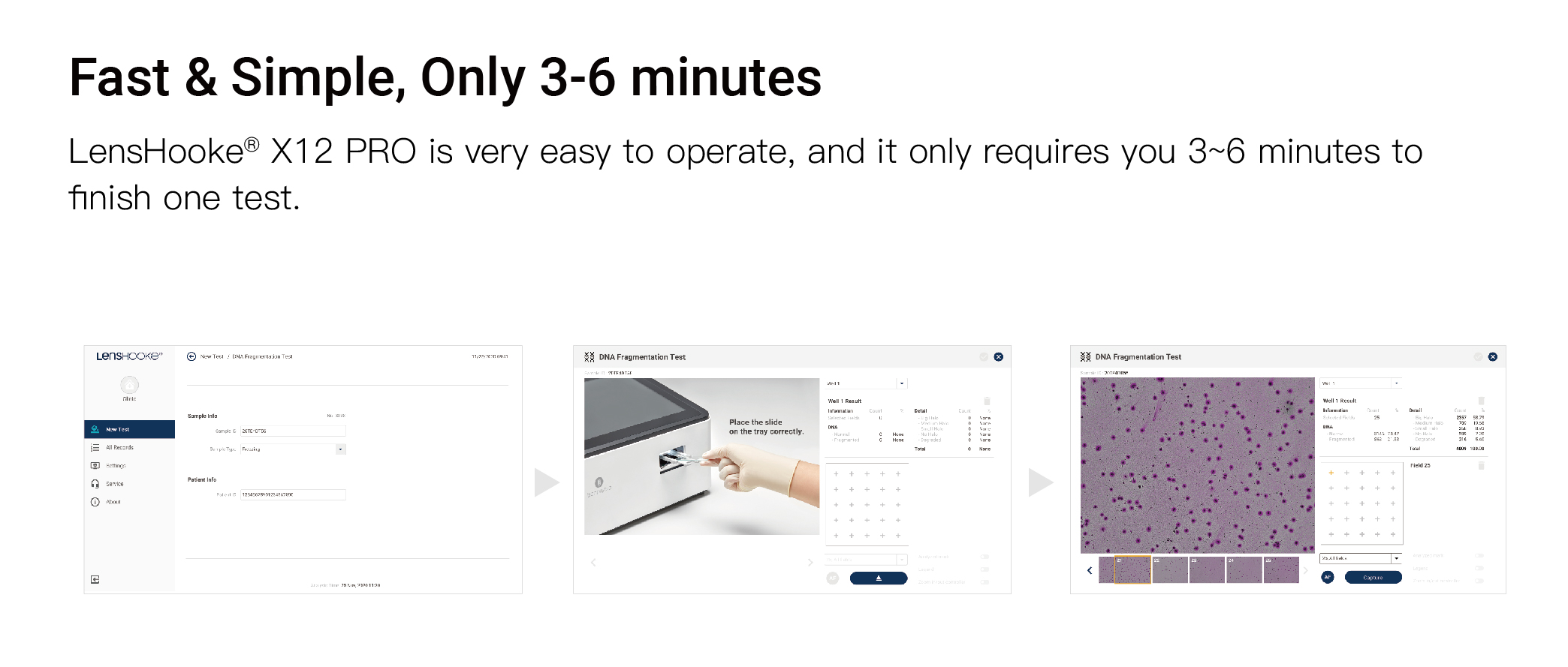 LensHooke X12 PRO Semen Analysis System - LensHooke