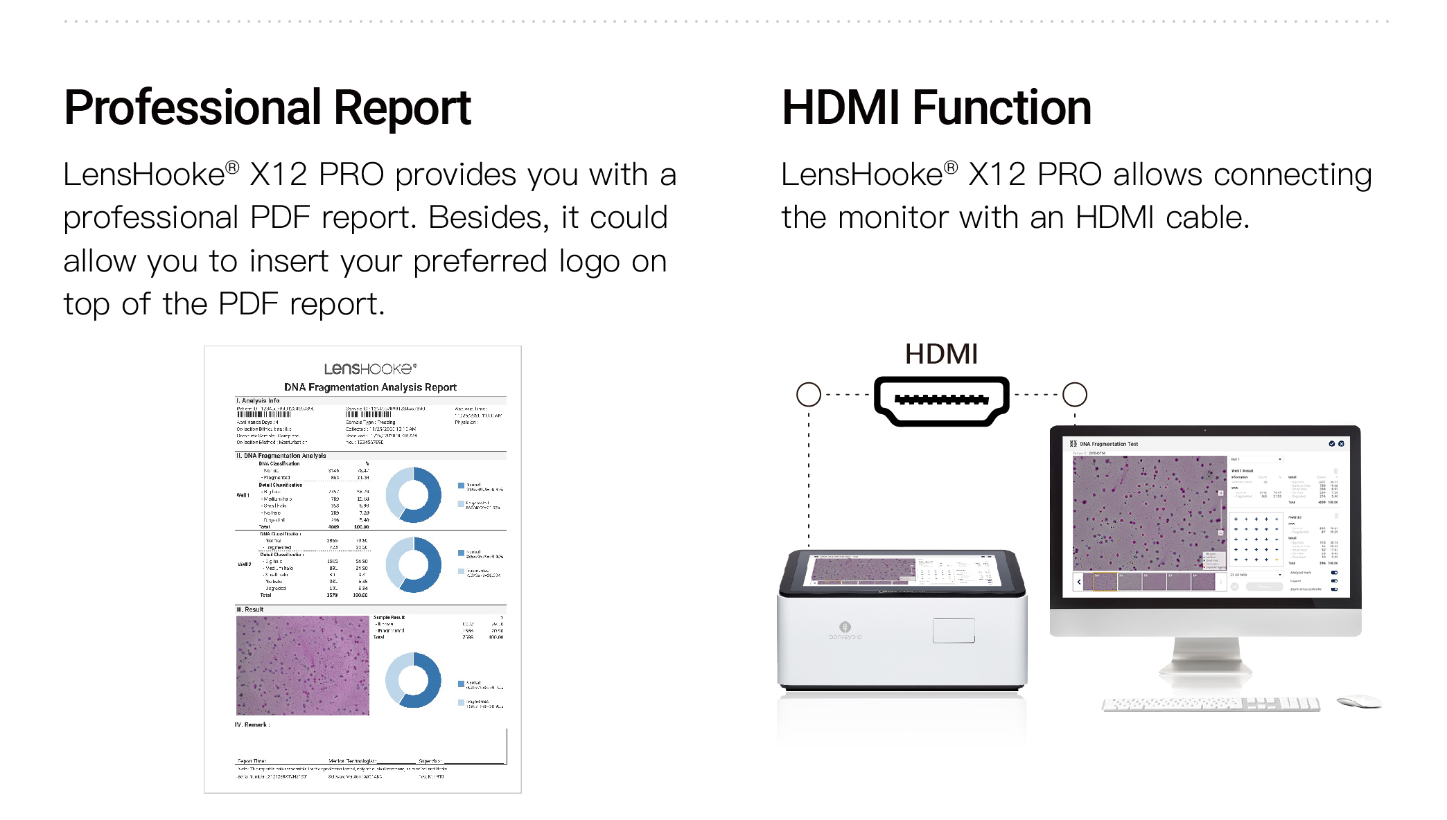 LensHooke X12 PRO Semen Analysis System - LensHooke