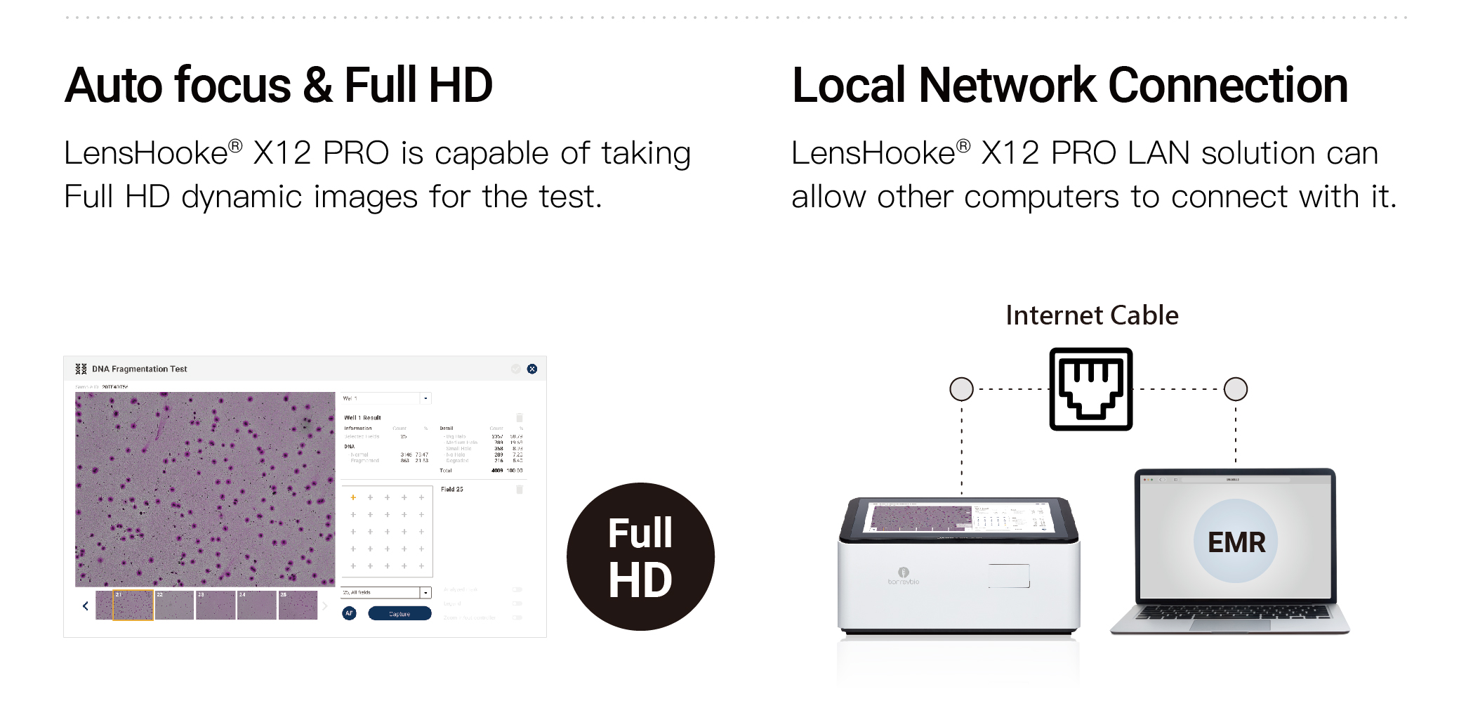 LensHooke X12 PRO Semen Analysis System - LensHooke