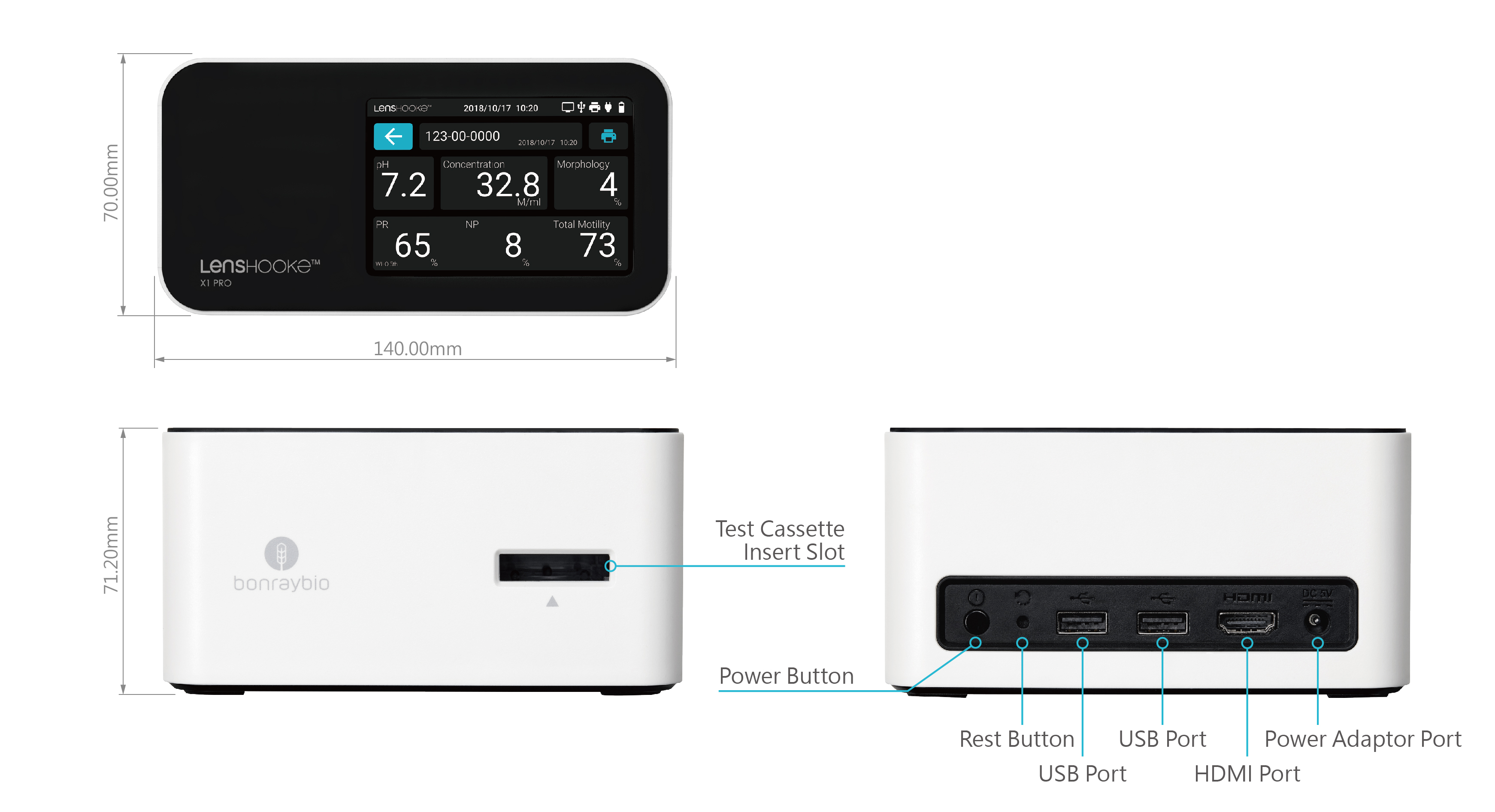 X1 PRO Semen Quality Analyzer - LensHooke