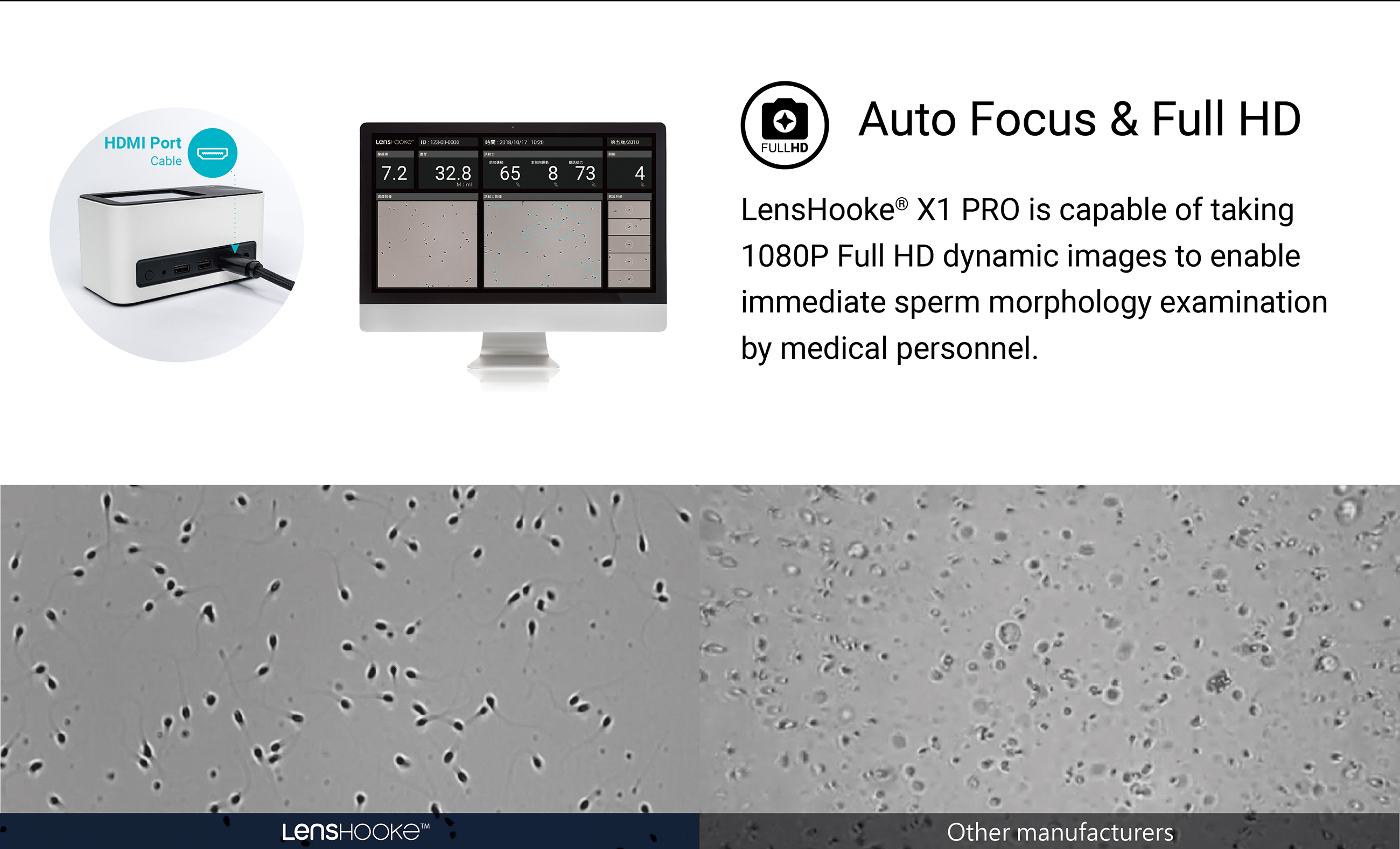X1 PRO Semen Quality Analyzer - LensHooke